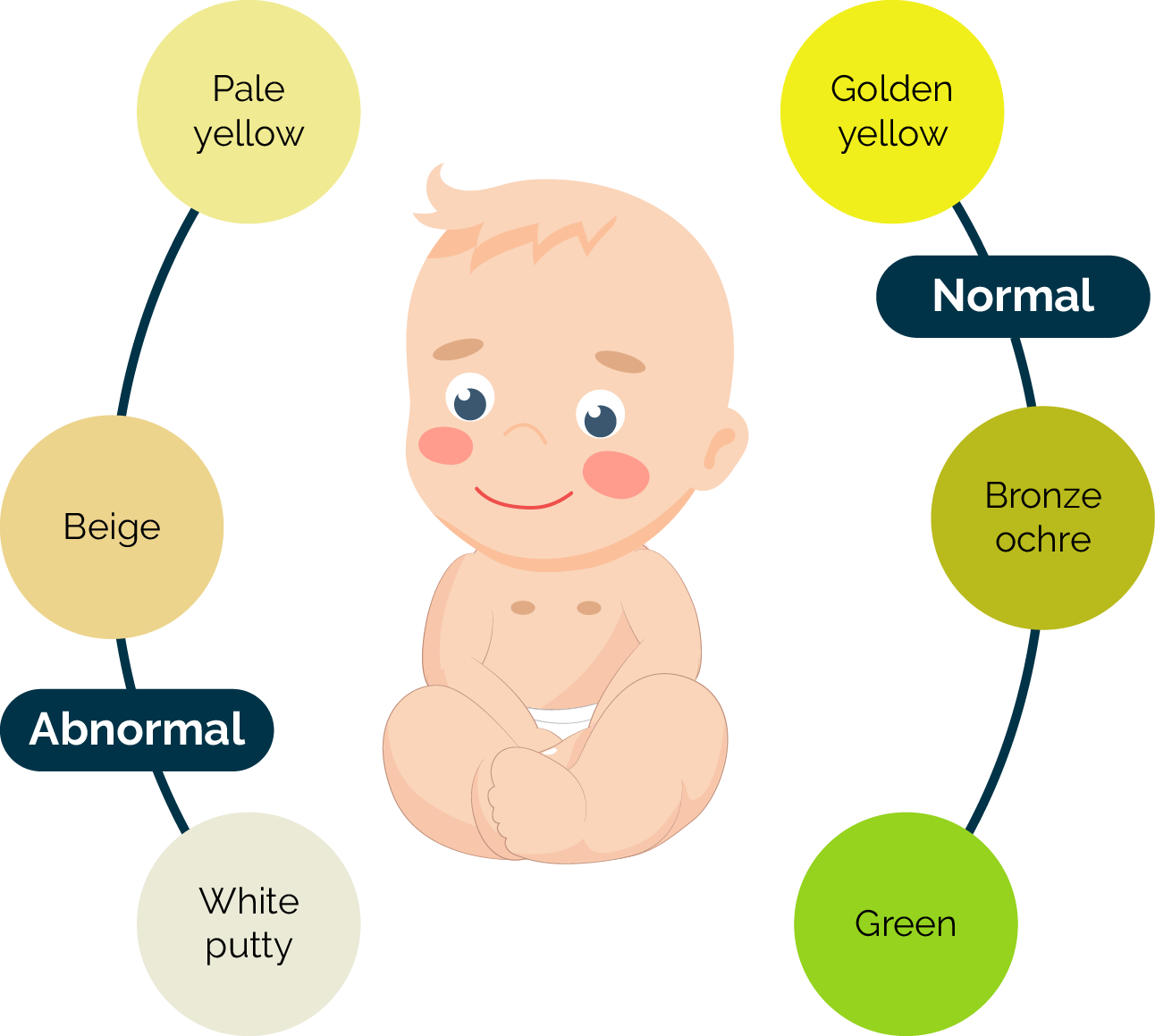 Cholestasis in paediatric patients - Rarecholestasis